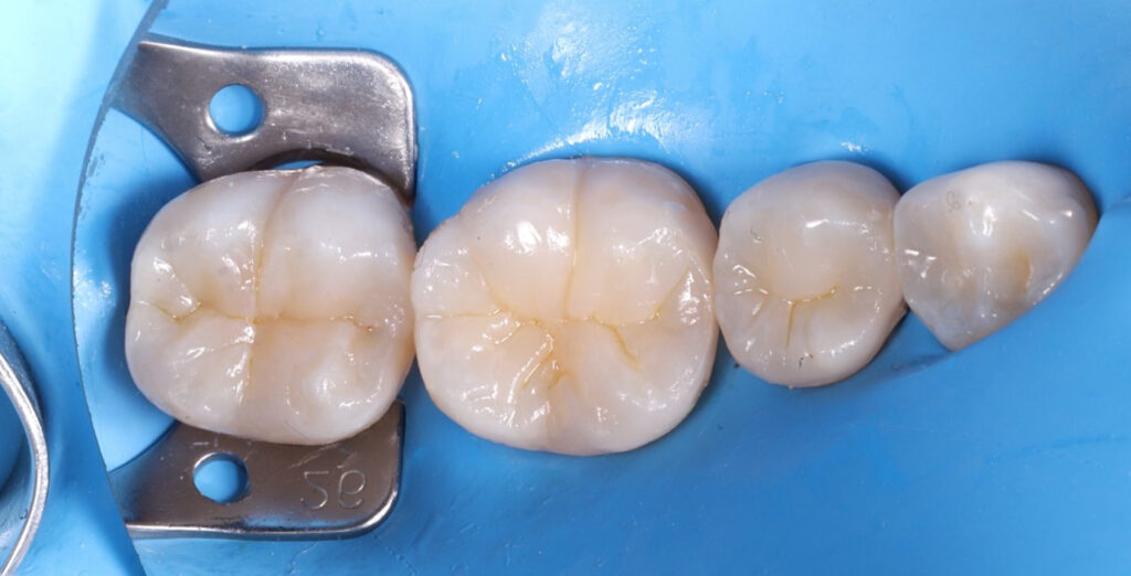 Приклади робіт – S2 Dental
